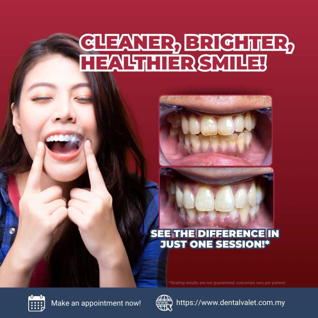 Dental Valet Pediatric Specialist Dental Clinic for Families, & Special ...